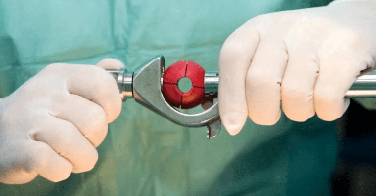 Unnecessary laparoscopy for dye insufflation